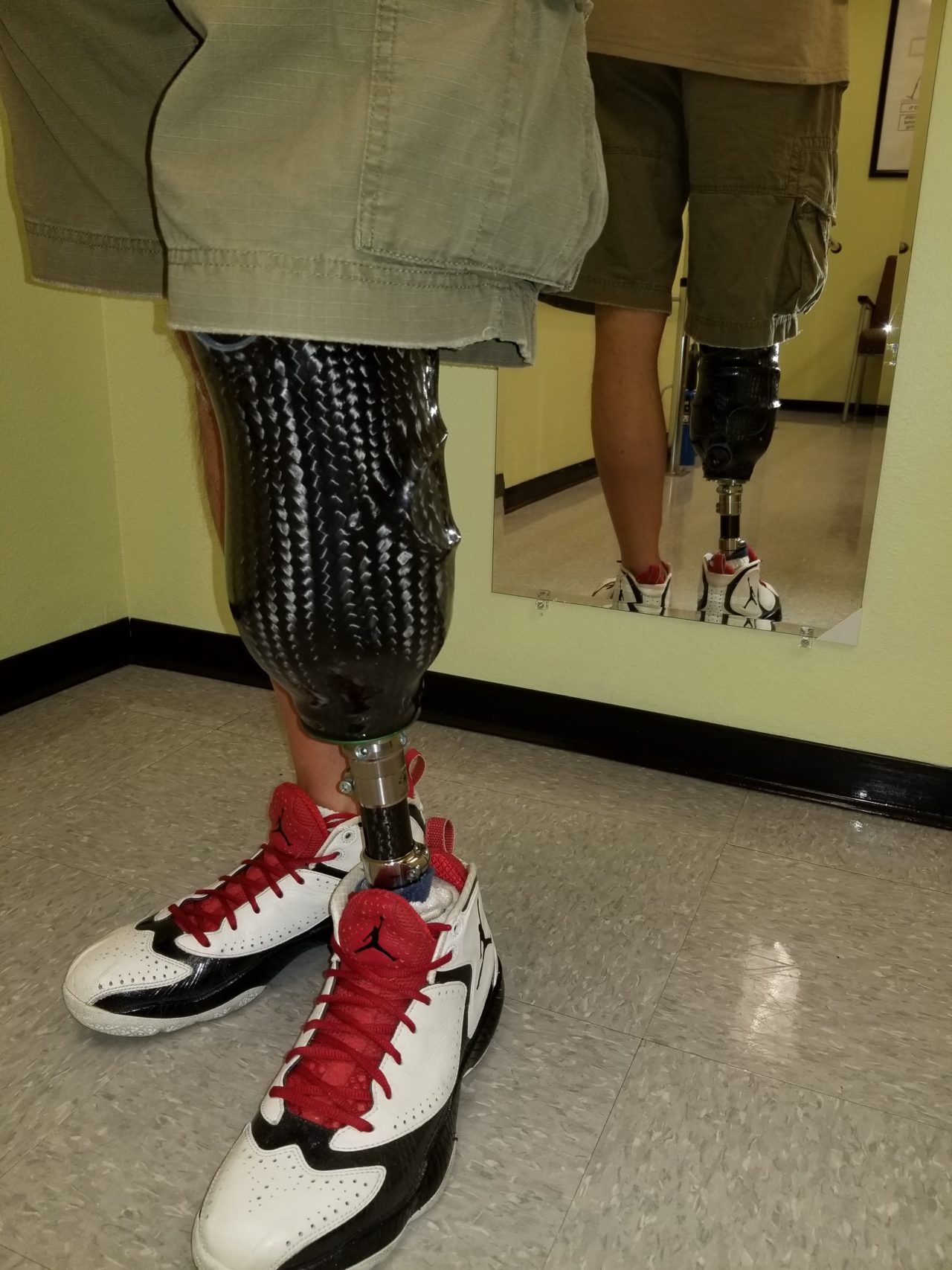 Services - Nevada Limb & Brace